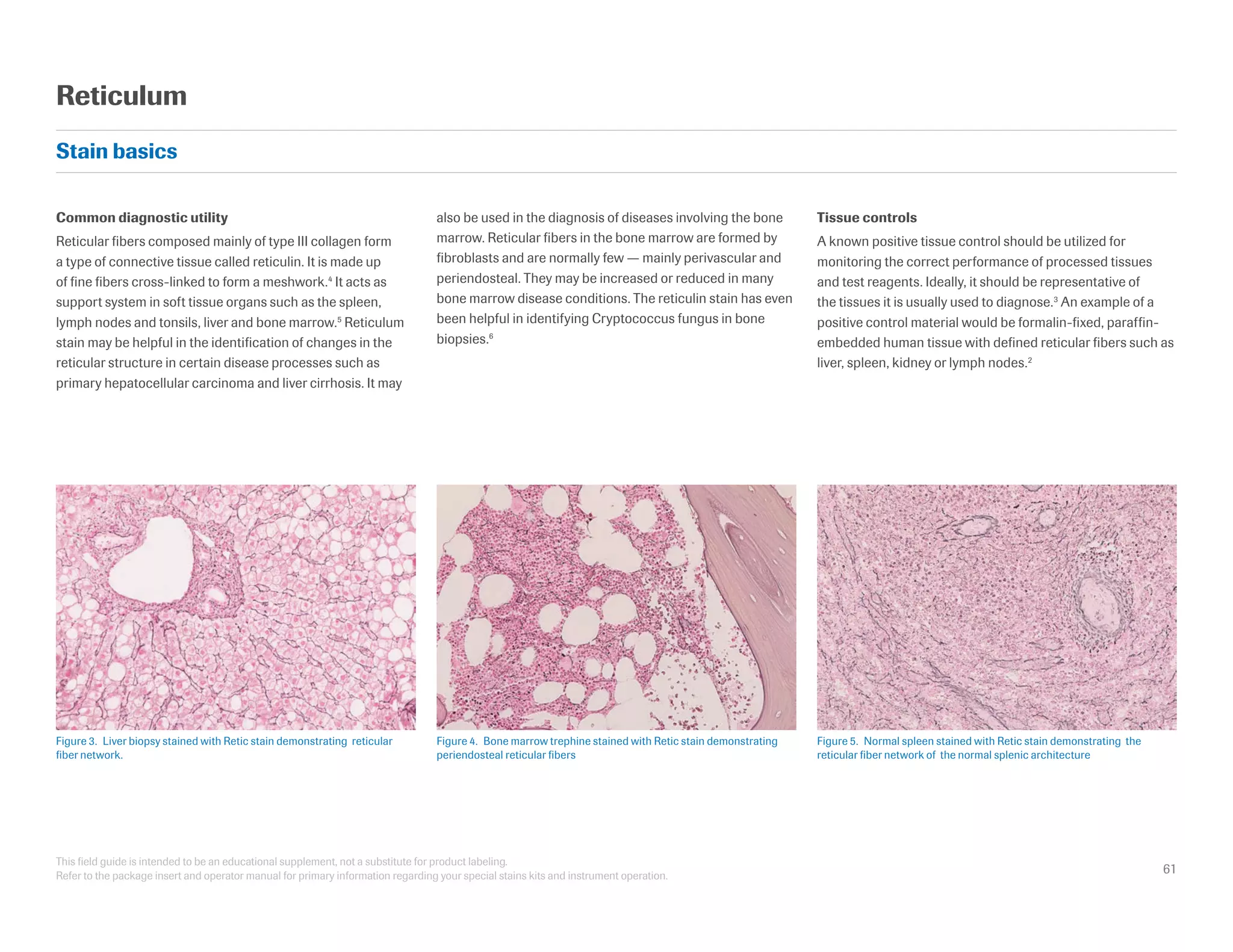 VENTANA BenchMark Special Stains General Reference Guide | PDF