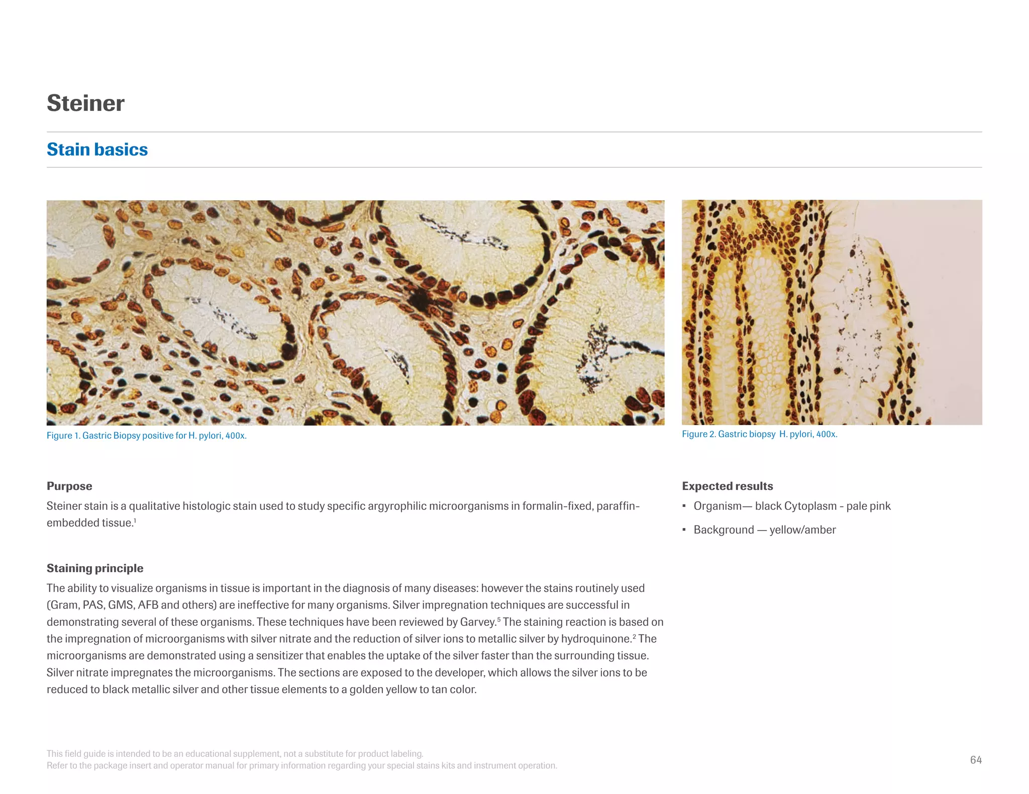 VENTANA BenchMark Special Stains General Reference Guide | PDF