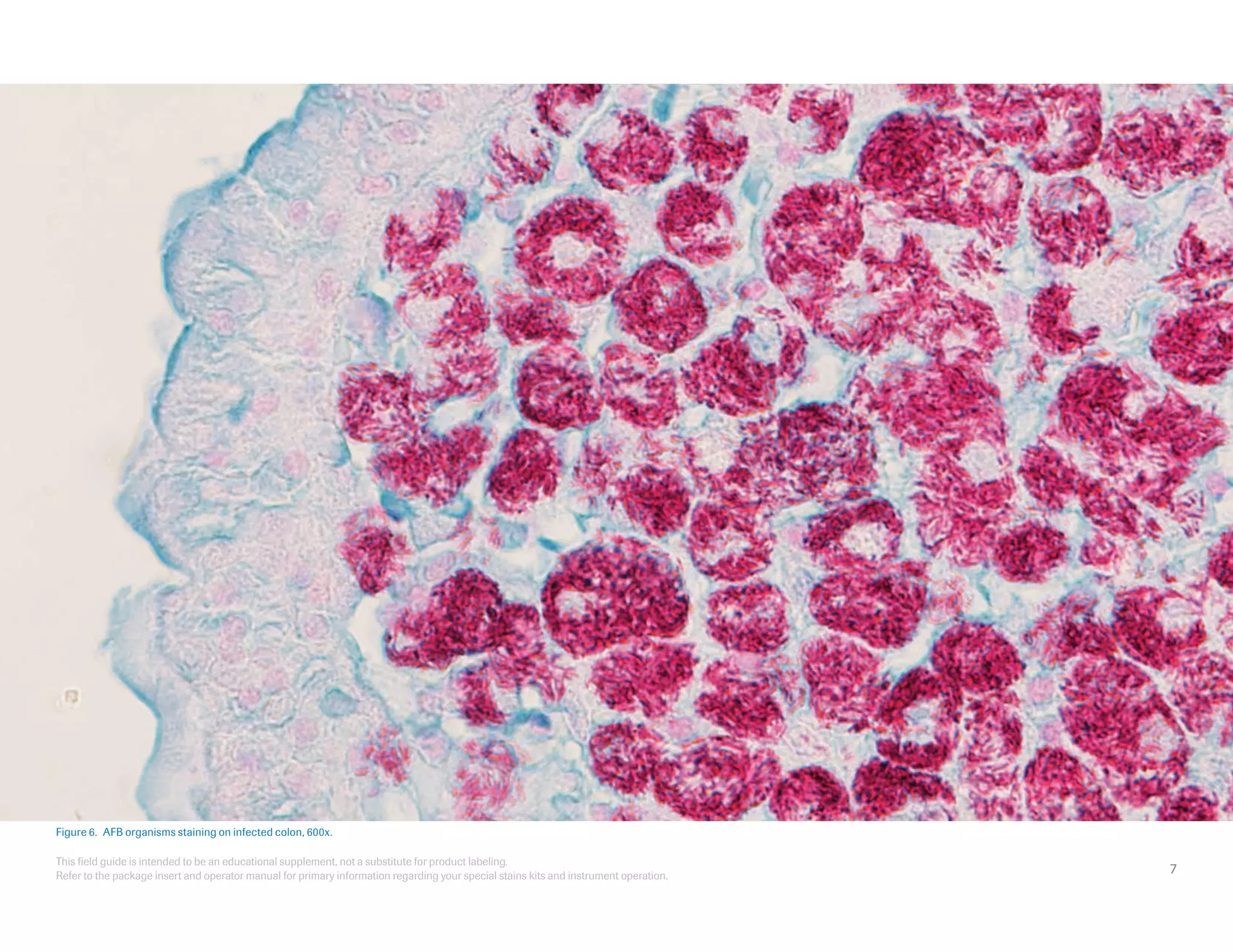 VENTANA BenchMark Special Stains General Reference Guide | PDF