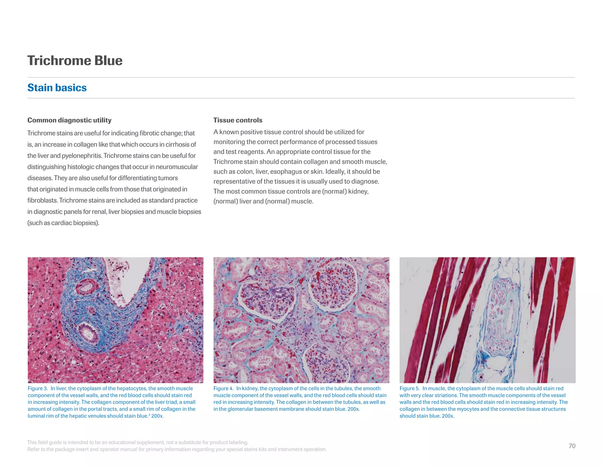 VENTANA BenchMark Special Stains General Reference Guide | PDF
