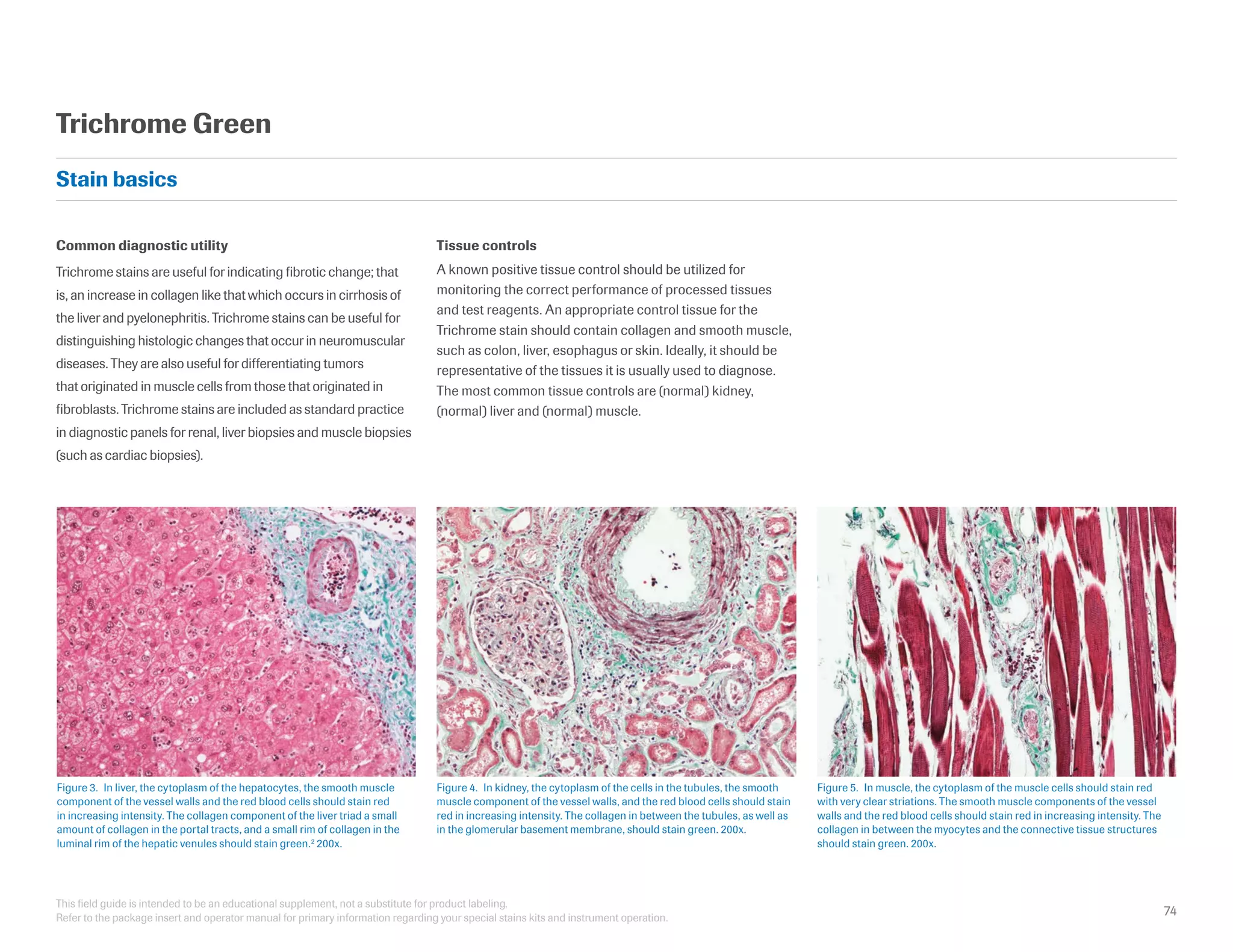 VENTANA BenchMark Special Stains General Reference Guide | PDF
