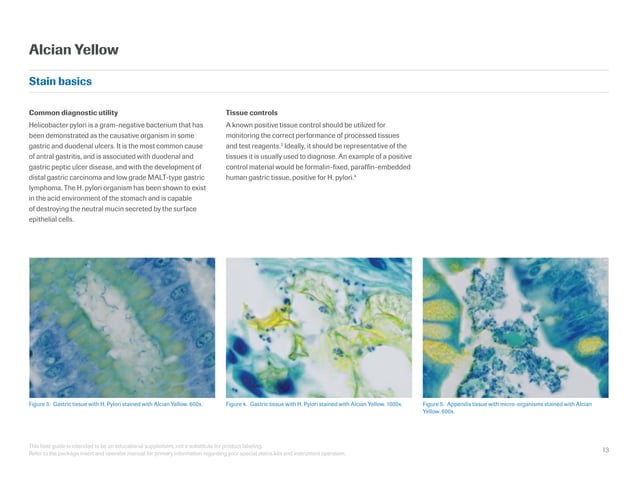 VENTANA BenchMark Special Stains General Reference Guide | PDF ...
