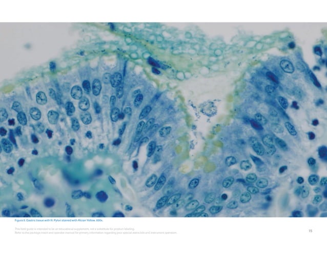 VENTANA BenchMark Special Stains General Reference Guide | PDF ...