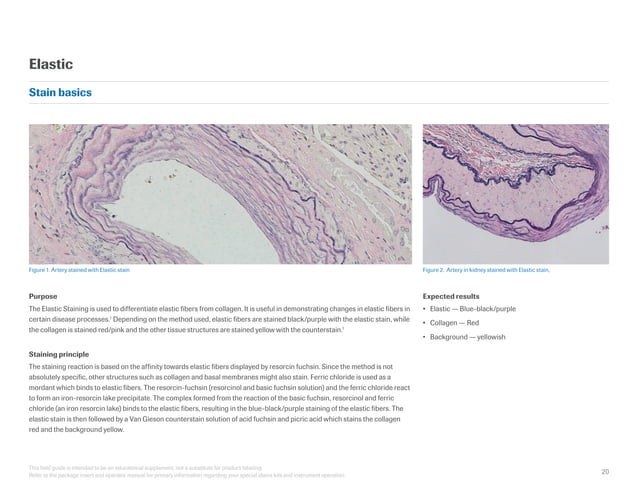 VENTANA BenchMark Special Stains General Reference Guide | PDF ...