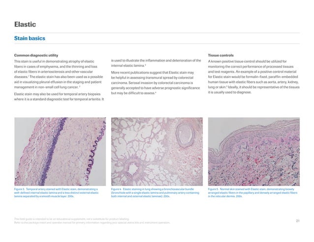 VENTANA BenchMark Special Stains General Reference Guide | PDF ...