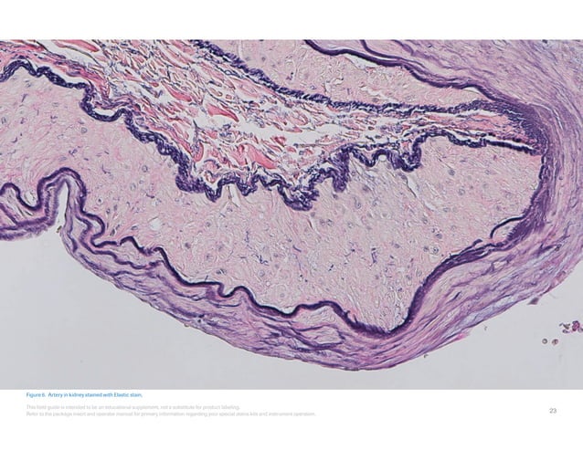 VENTANA BenchMark Special Stains General Reference Guide | PDF ...