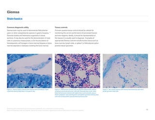 VENTANA BenchMark Special Stains General Reference Guide | PDF