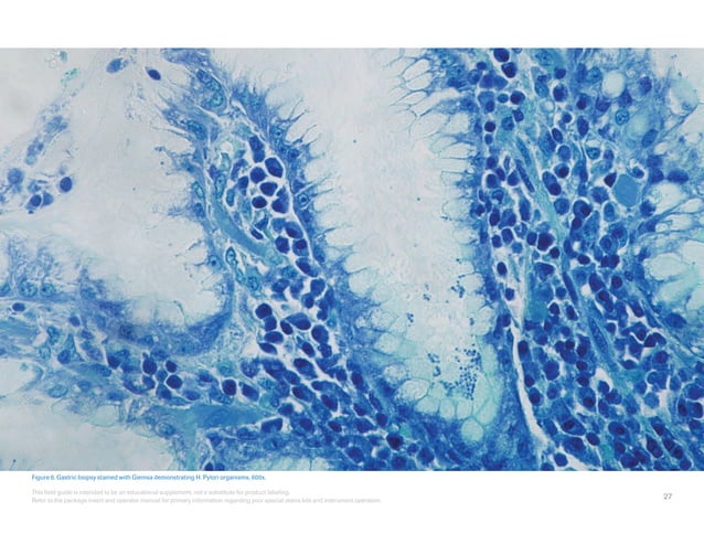 VENTANA BenchMark Special Stains General Reference Guide | PDF ...
