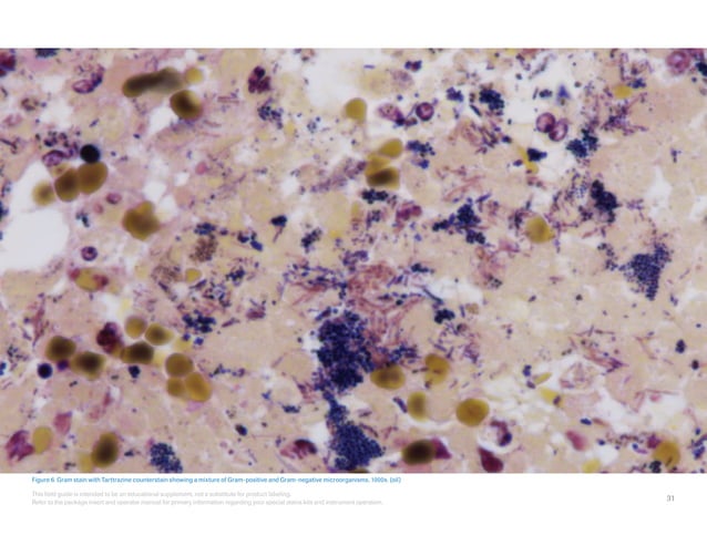 VENTANA BenchMark Special Stains General Reference Guide | PDF ...