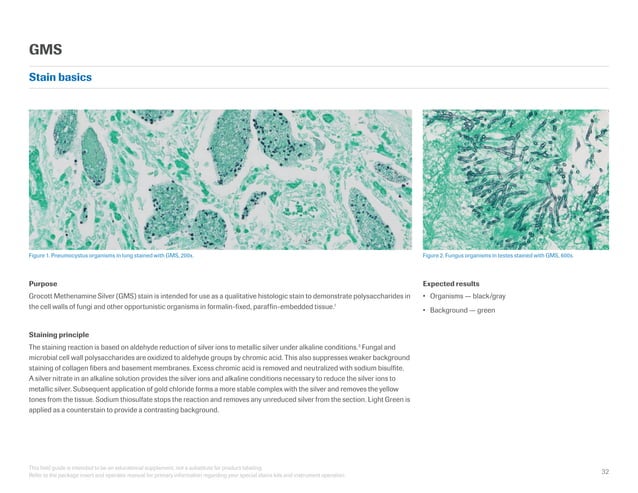 VENTANA BenchMark Special Stains General Reference Guide | PDF ...