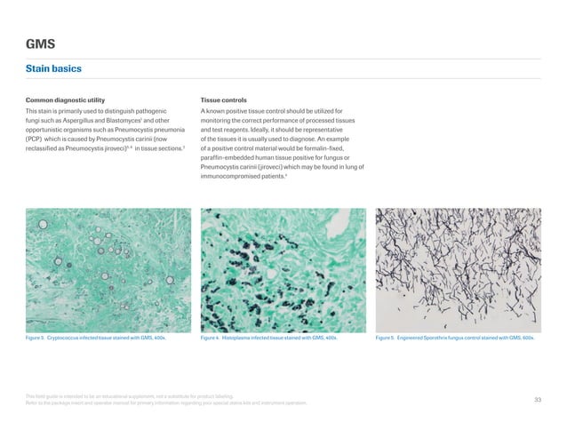VENTANA BenchMark Special Stains General Reference Guide | PDF ...