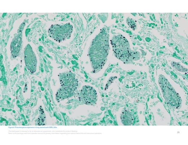 VENTANA BenchMark Special Stains General Reference Guide | PDF ...