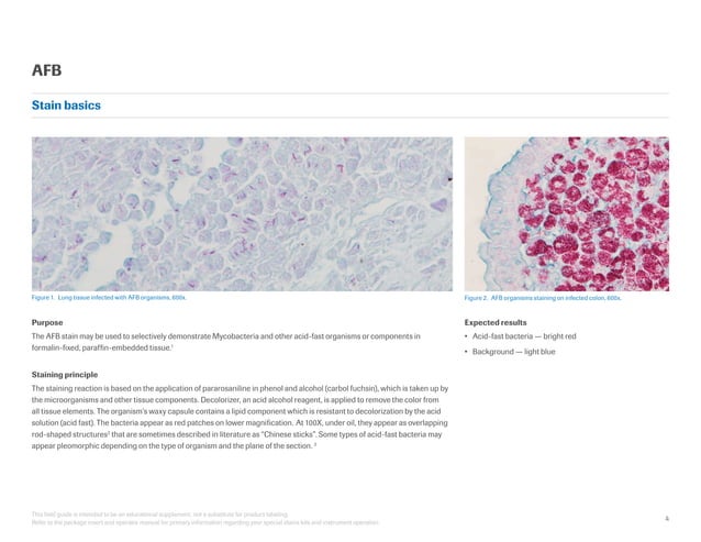 VENTANA BenchMark Special Stains General Reference Guide | PDF ...