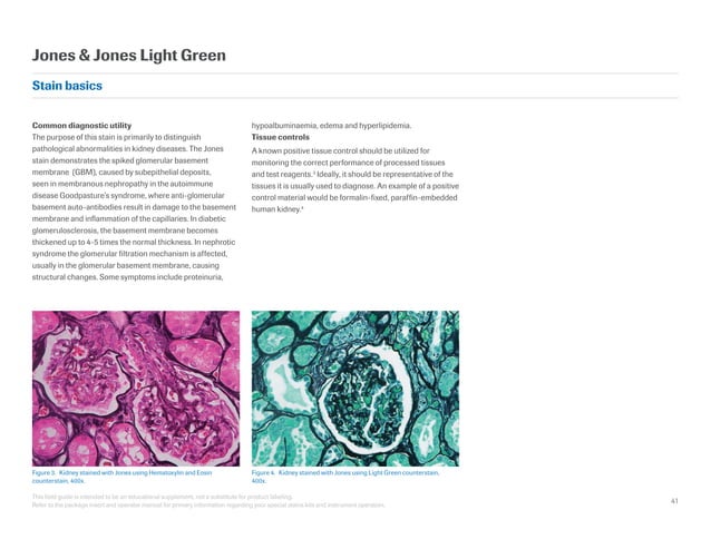 VENTANA BenchMark Special Stains General Reference Guide | PDF ...