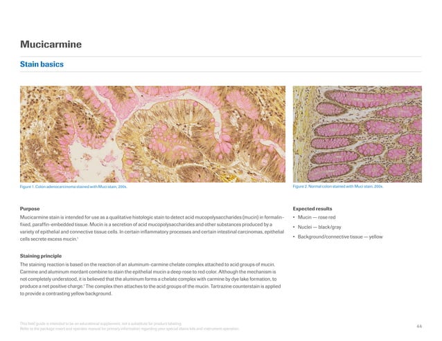 VENTANA BenchMark Special Stains General Reference Guide | PDF ...