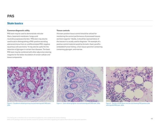 VENTANA BenchMark Special Stains General Reference Guide | PDF ...