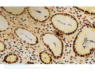 VENTANA BenchMark Special Stains General Reference Guide | PDF