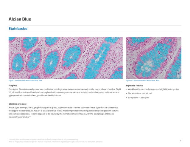 VENTANA BenchMark Special Stains General Reference Guide | PDF | Digestive Disorders | Diseases ...