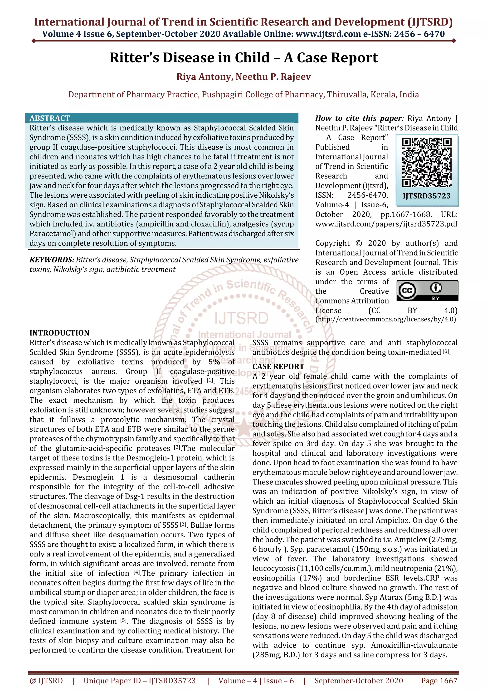 Ritters Disease in Child A Case Report | PDF