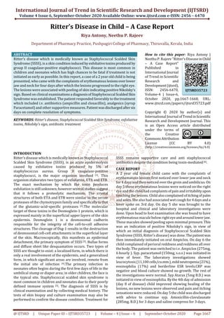 Ritters Disease in Child A Case Report | PDF