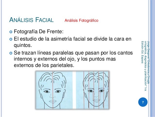 30320818 analisis-facial