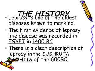 National Program LEPROSY National Program LEPROSY.ppt.ppt