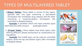 Multilayer drug delivery system: Tablet. | PPT