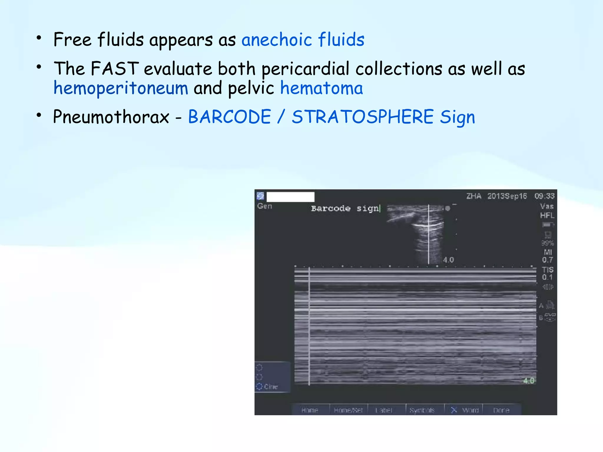 FAST focused assessment with sonography for trauma | PPTX