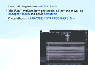 FAST focused assessment with sonography for trauma | PPTX