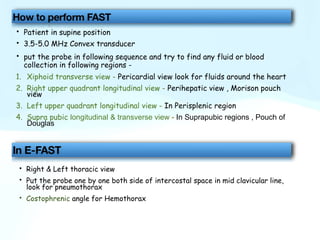 FAST focused assessment with sonography for trauma | PPTX