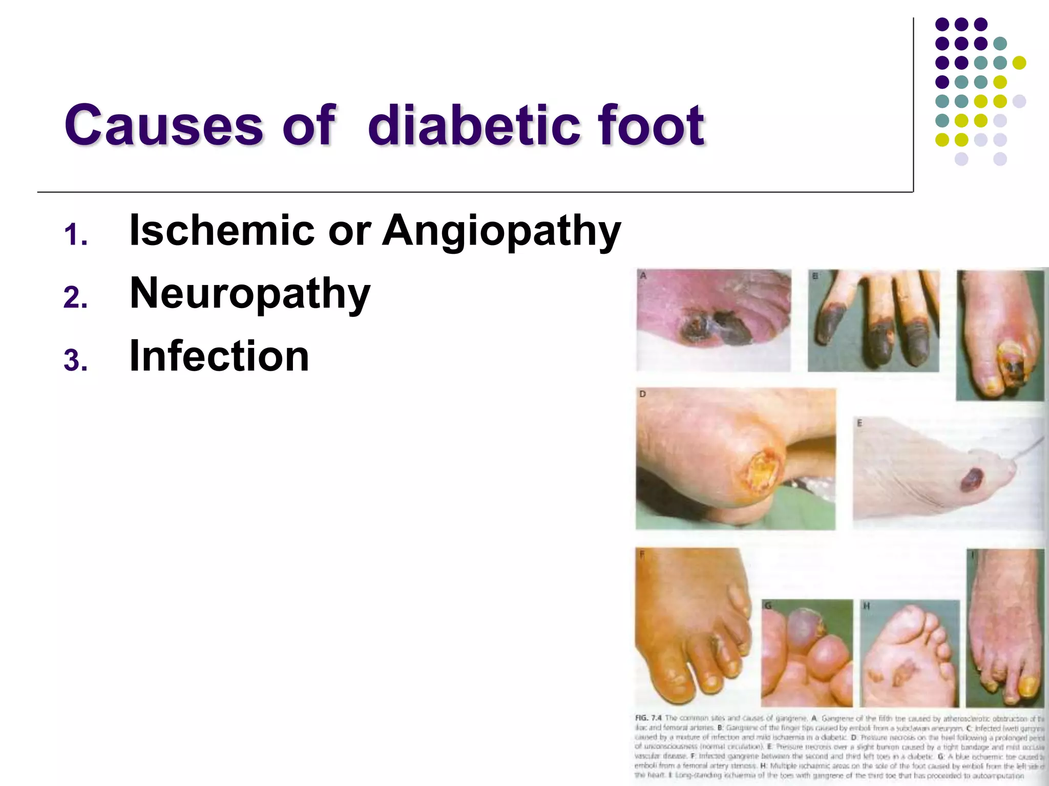 Diabetic foot.ppt