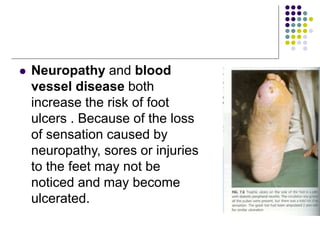 Diabetic foot.ppt
