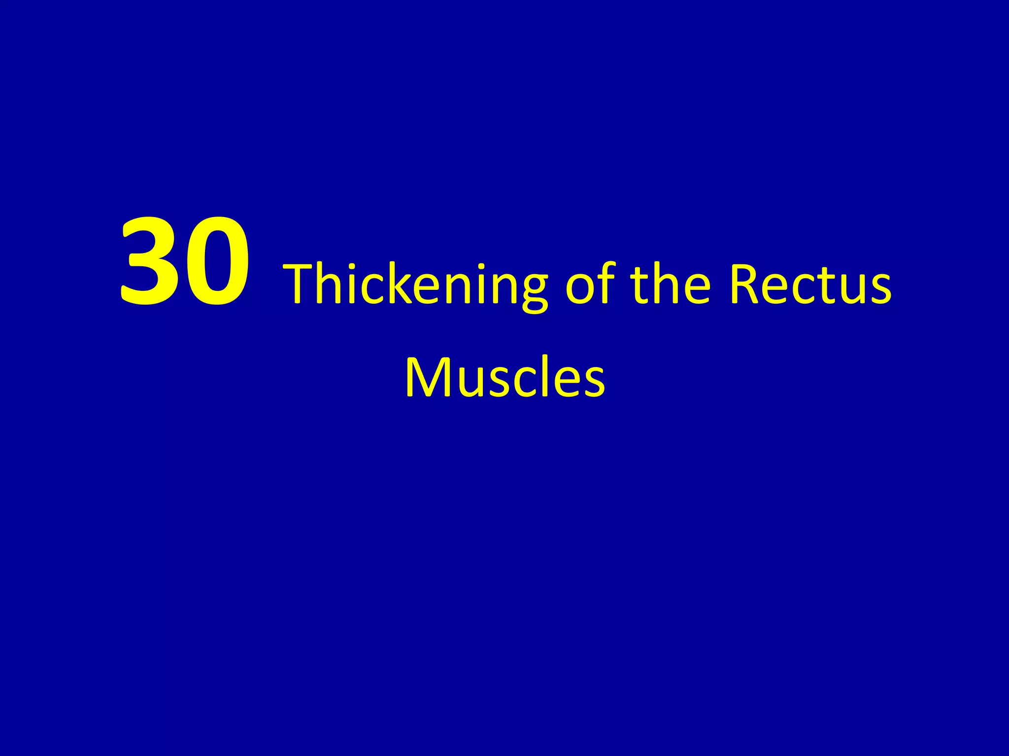 30 thickening of the rectus muscles | PPTX