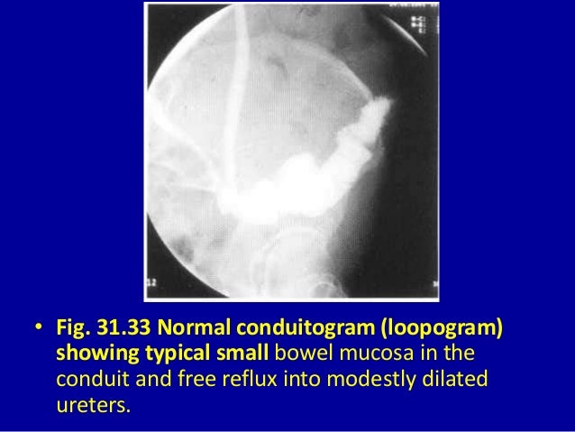 31 DAVID SUTTON PICTURES THE BLADDER AND PROSTATE