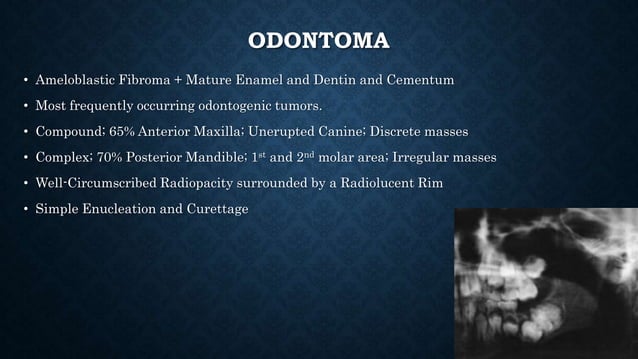 Benign Odontogenic Tumors of the Jaws | PPT