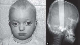 Radiographic Features of Developmental Anomalies in the Face and Jaws ...