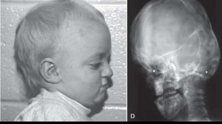 Radiographic Features of Developmental Anomalies in the Face and Jaws ...