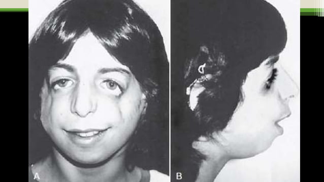 Radiographic Features of Developmental Anomalies in the Face and Jaws ...