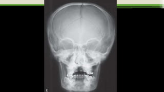 Radiographic Features of Developmental Anomalies in the Face and Jaws ...