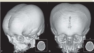 Radiographic Features of Developmental Anomalies in the Face and Jaws ...