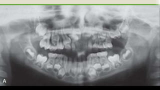 Radiographic Features of Developmental Anomalies in the Face and Jaws ...
