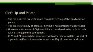 Radiographic Features of Developmental Anomalies in the Face and Jaws ...