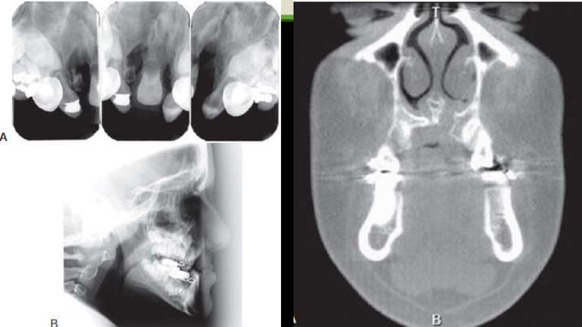 Radiographic Features of Developmental Anomalies in the Face and Jaws ...
