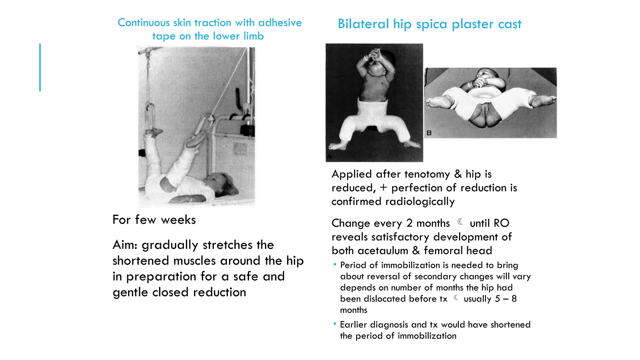 Developmental Dysplasia of the Hip-1.pptx