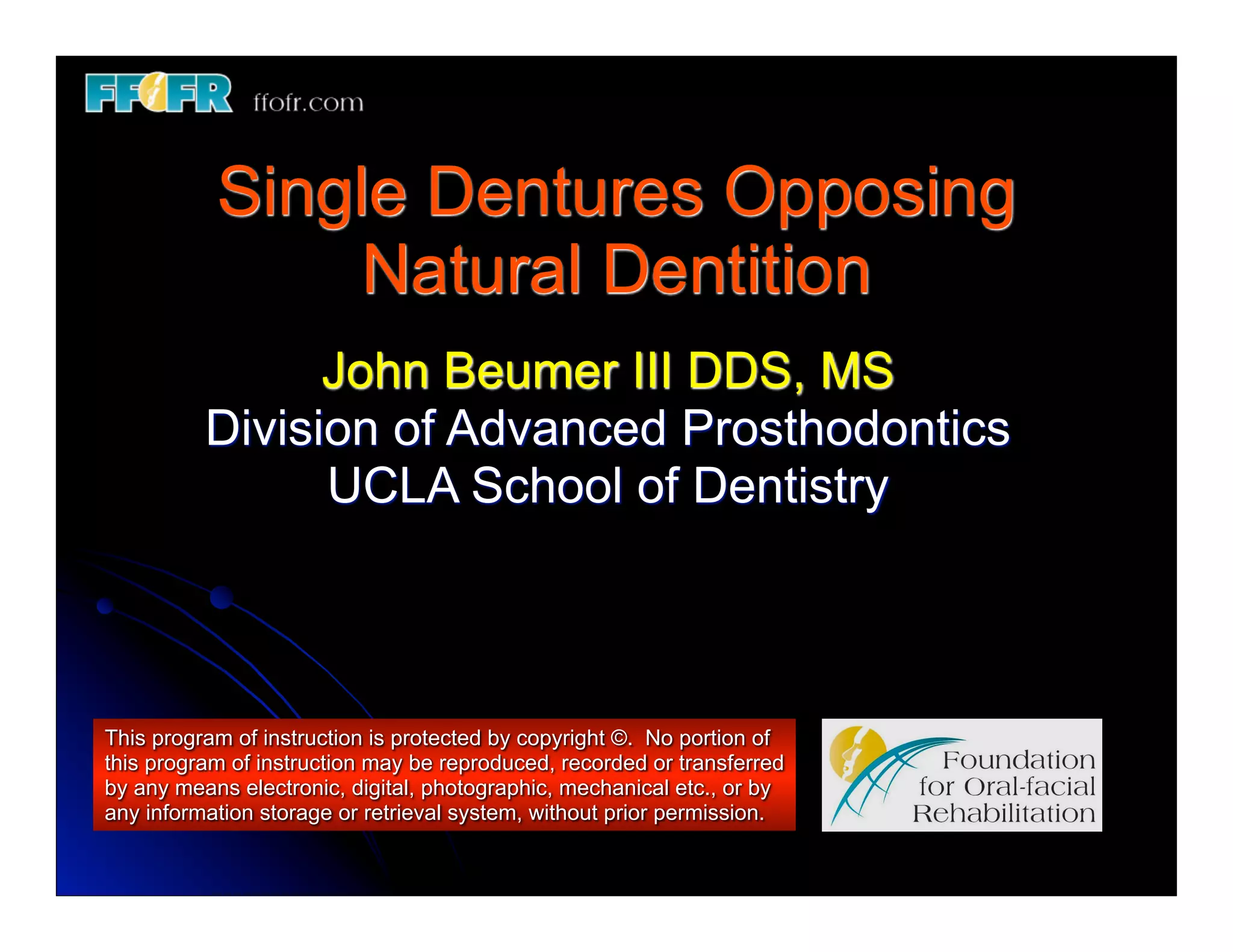 31.(new)single dentures opposing natural dentition (n) | PDF