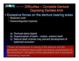 31.(new)single dentures opposing natural dentition (n) | PDF