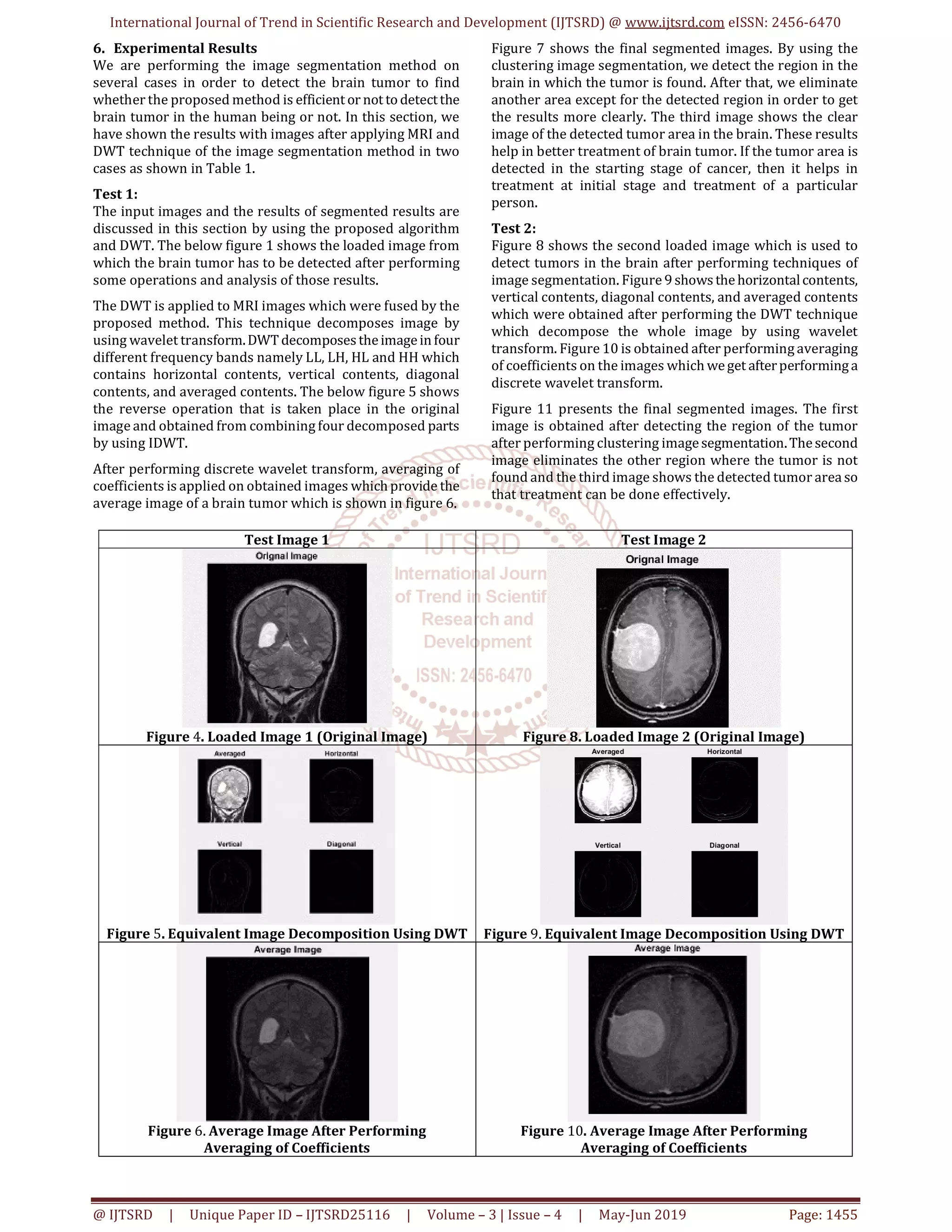 MRI Image Segmentation by Using DWT for Detection of Brain Tumor | PDF