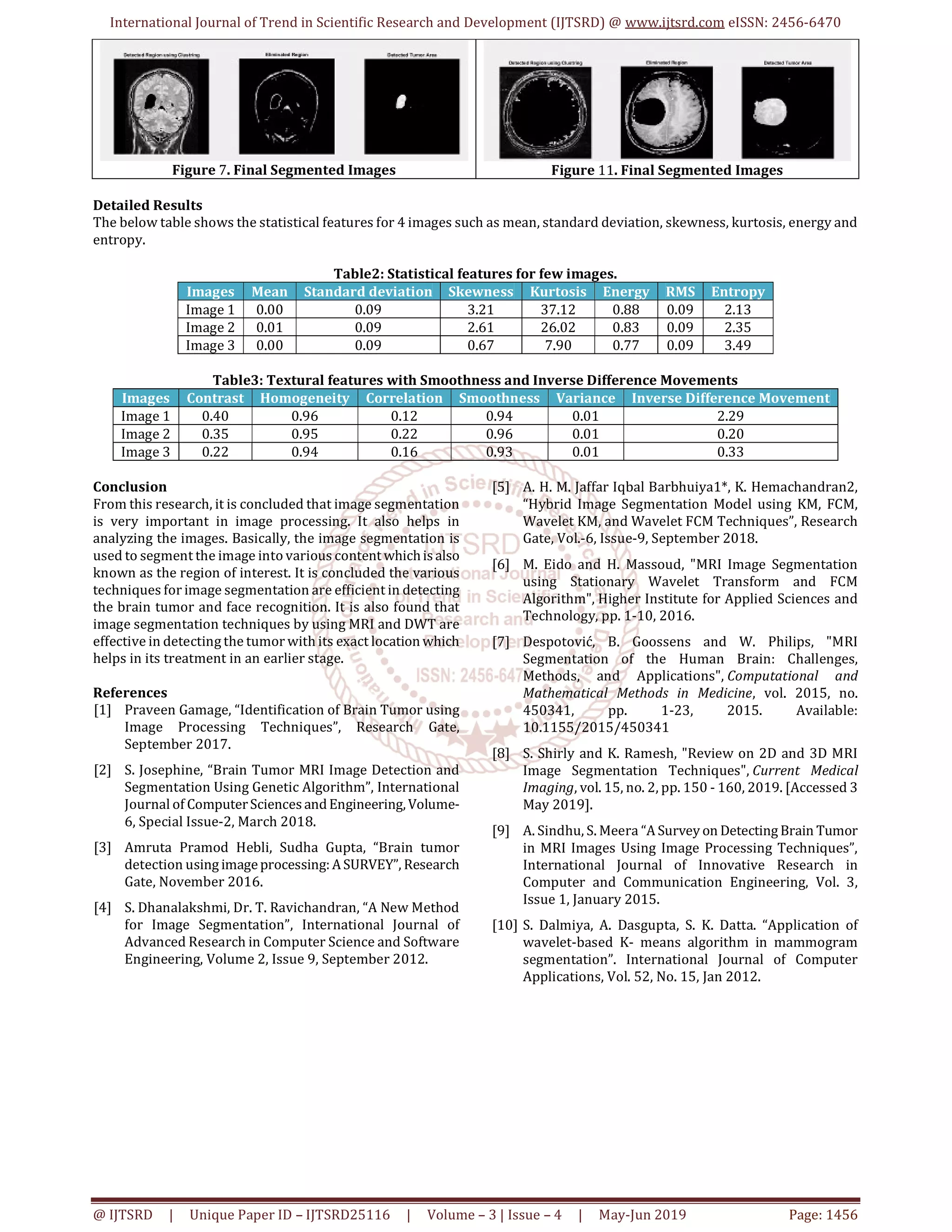 Mri Image Segmentation By Using Dwt For Detection Of Brain Tumor Pdf