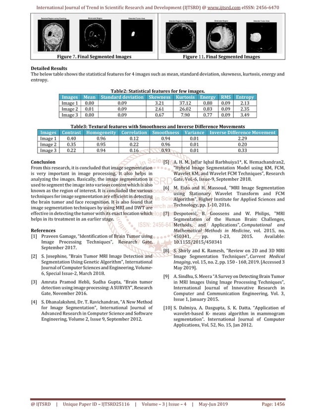MRI Image Segmentation by Using DWT for Detection of Brain Tumor | PDF
