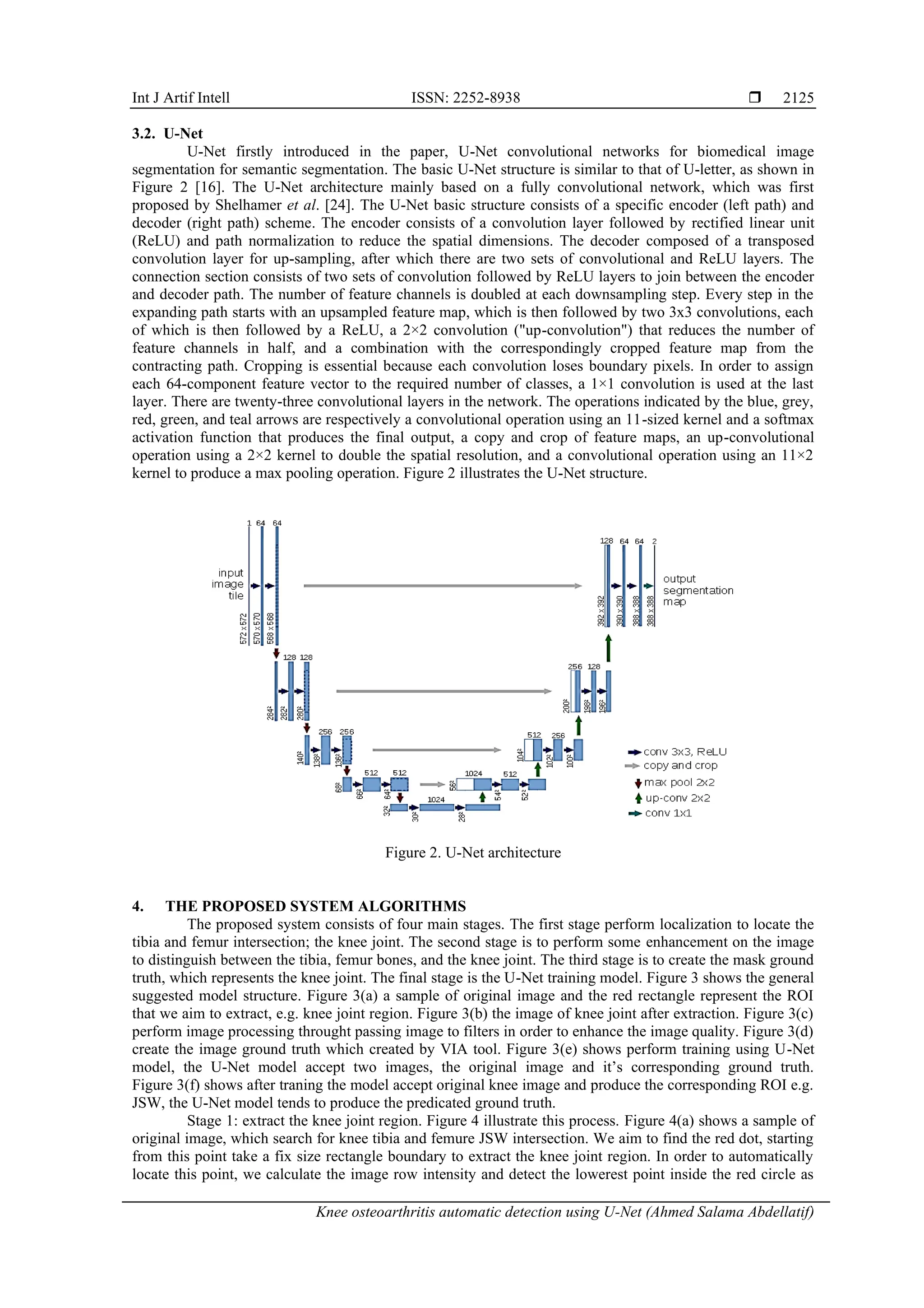 Knee osteoarthritis automatic detection using U-Net | PDF